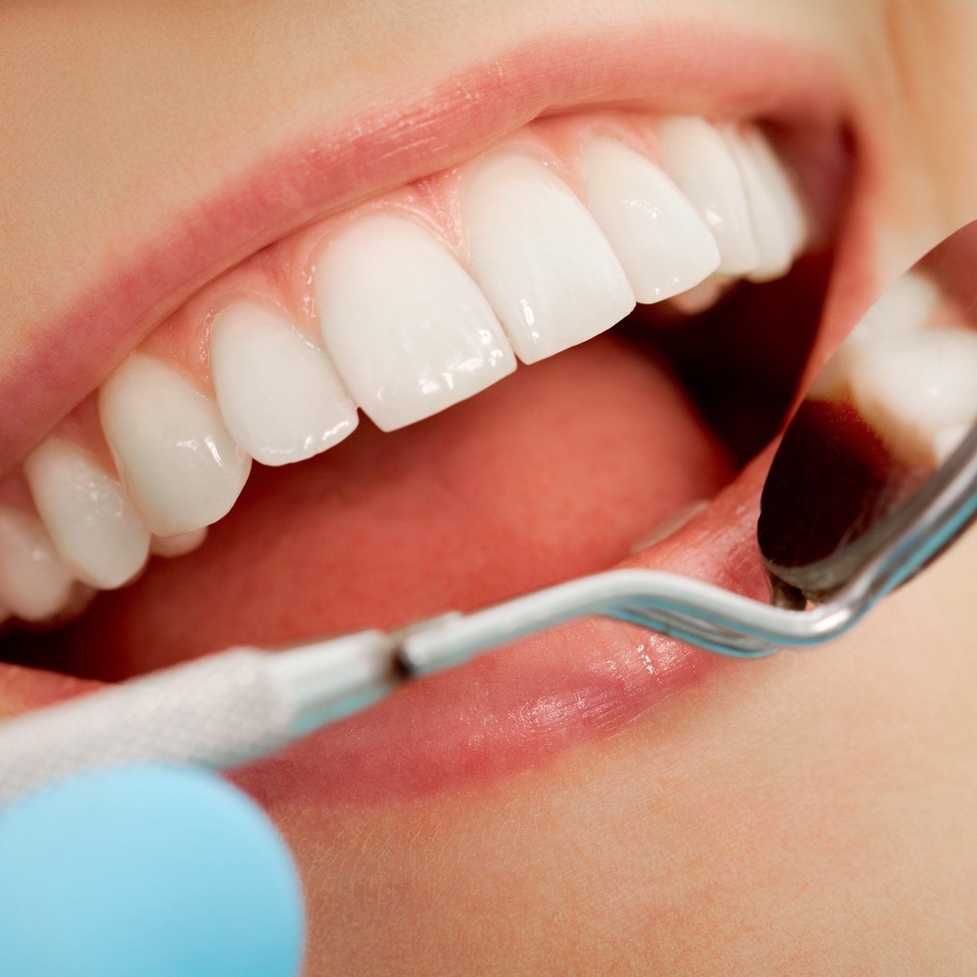 North Creek Dental Care-Everett